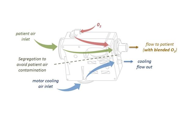 MFA0296 - Turbine Centrifuge pour Assistance Respiratoire